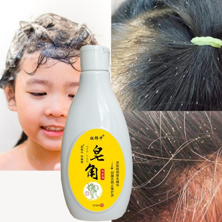 Therapeutic Shampoo Anti-Dandruff Treatment - Hair Candy Beauty